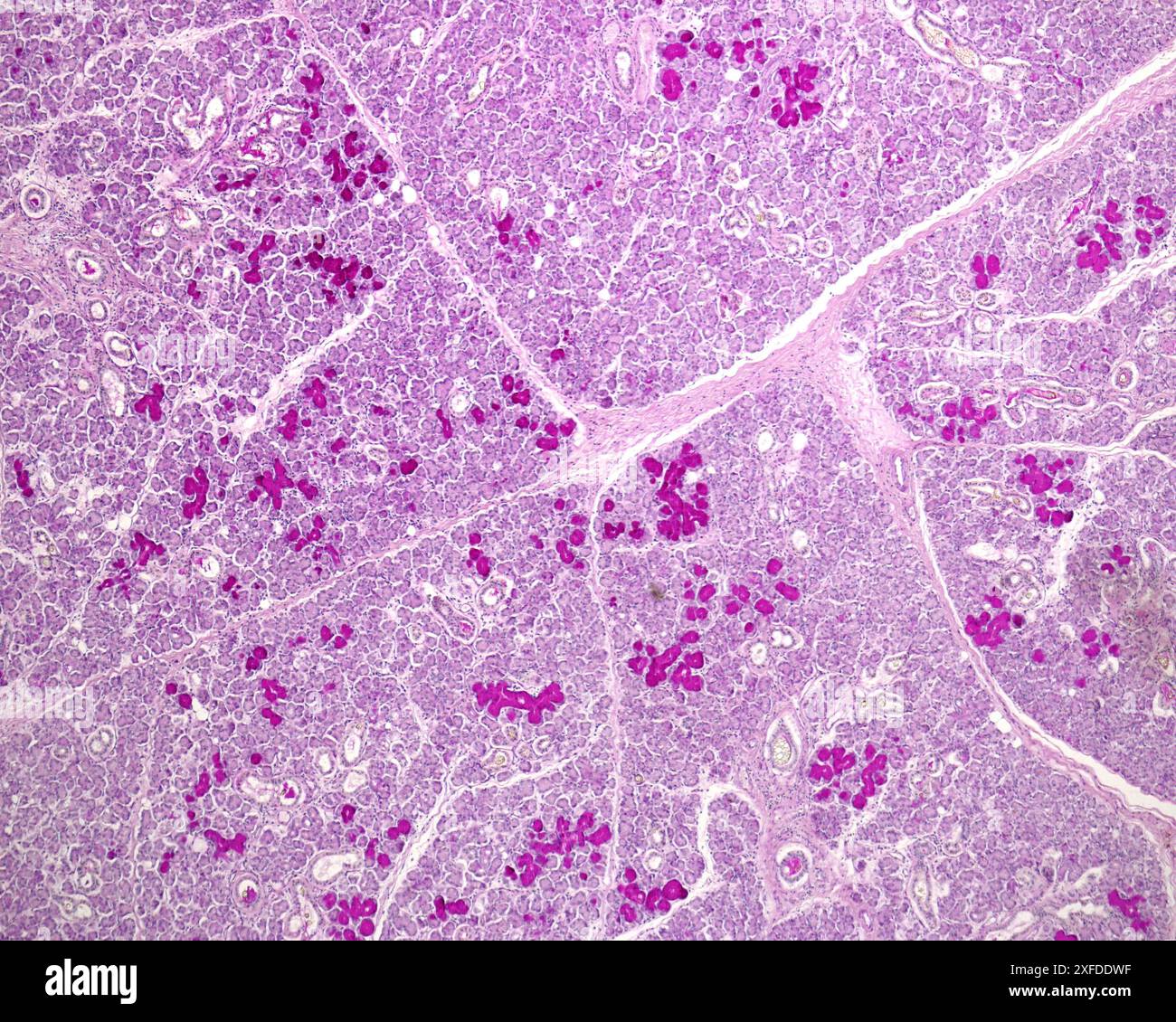 Submandibular gland, light micrograph. The submandibular, or ...