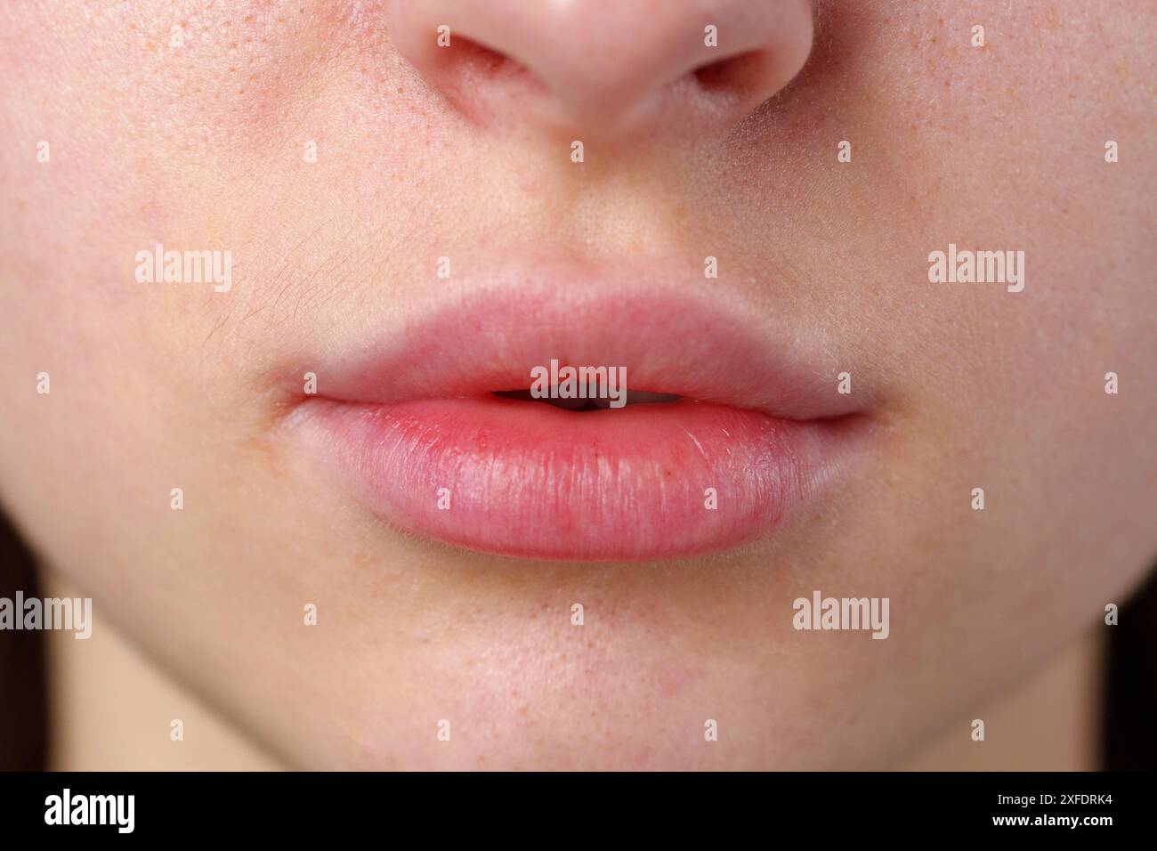 Close Up of Womans Lips and Nose Stock Photo - Alamy