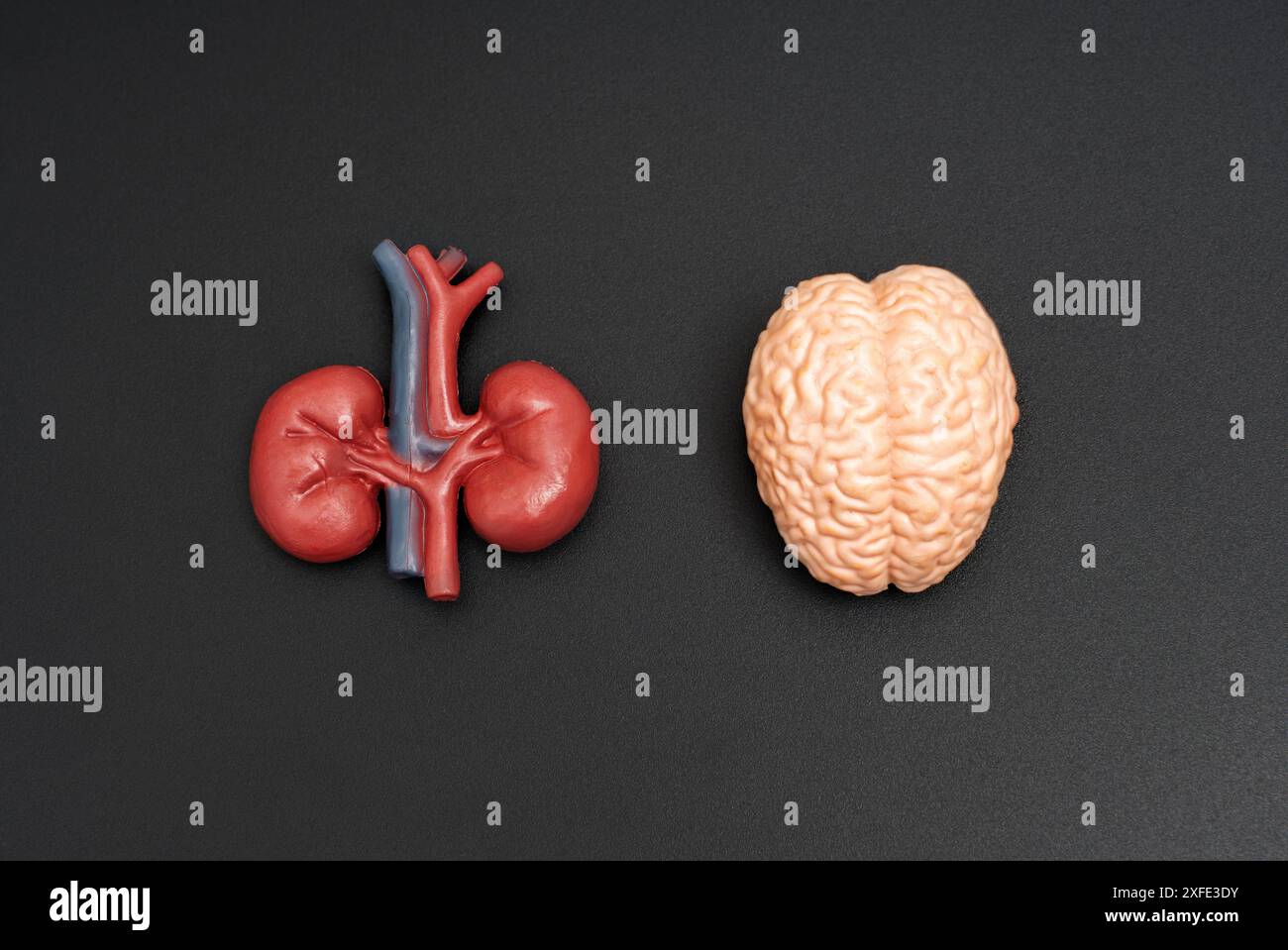 Realistic brain and kidney models isolated on a sleek black background ...