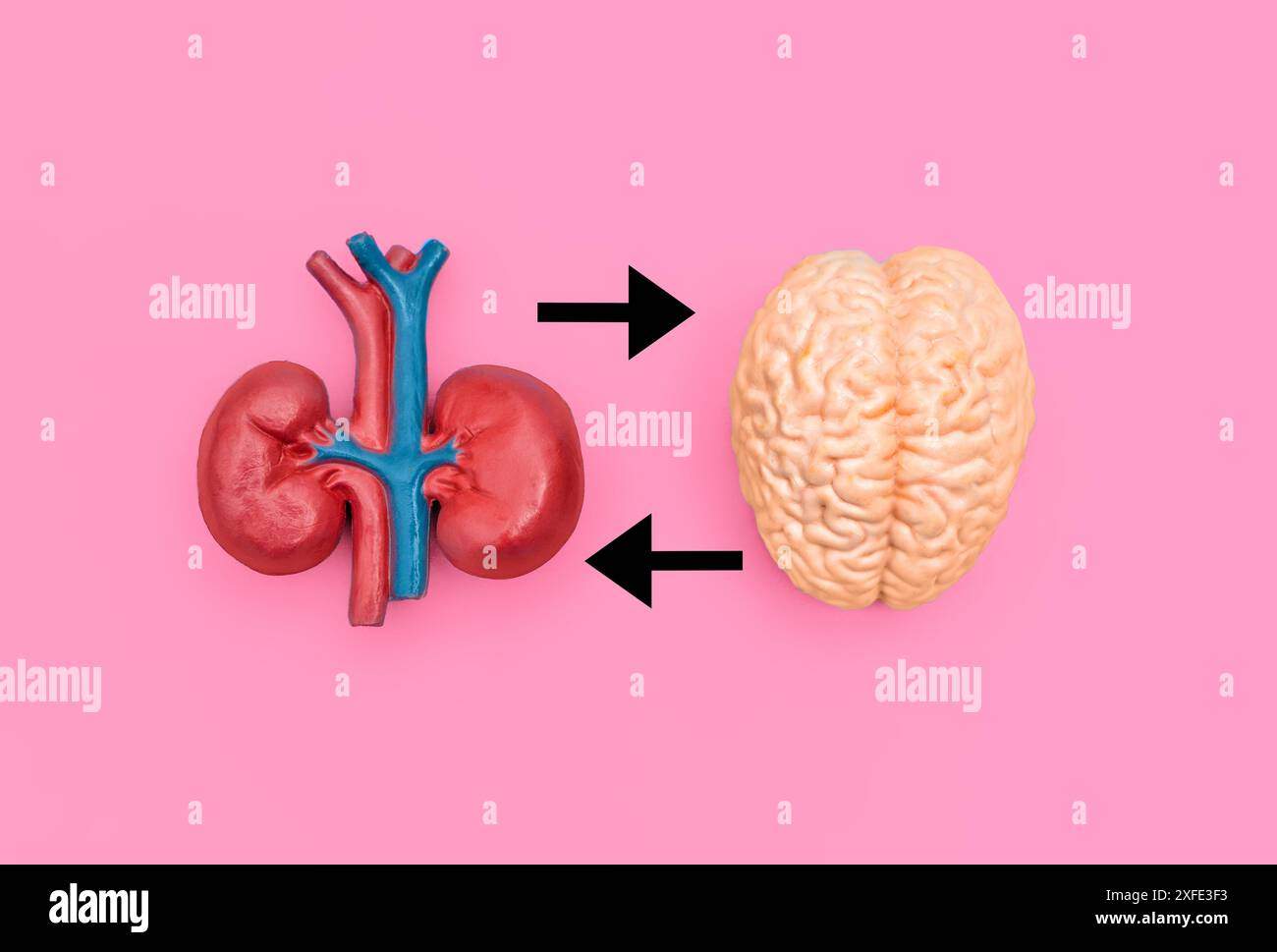 Anatomically correct human brain and kidney models interconnected by ...