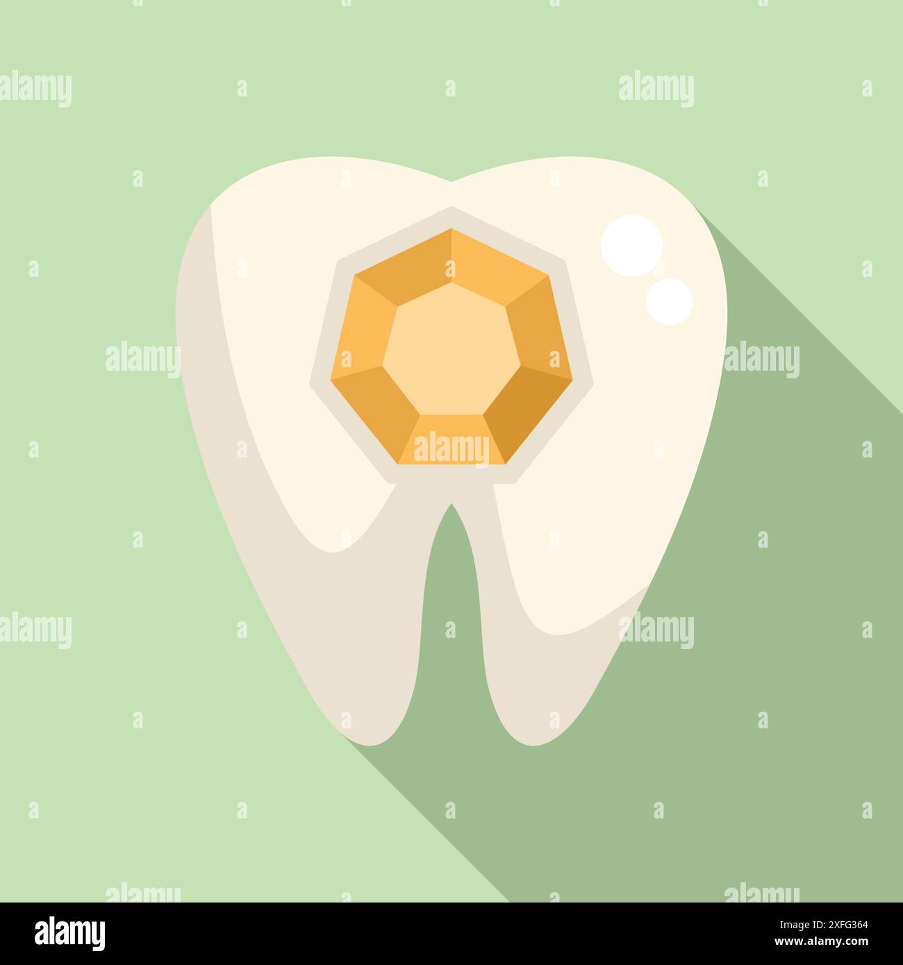 Tooth implant is showing a golden diamond inlay procedure Stock Vector ...