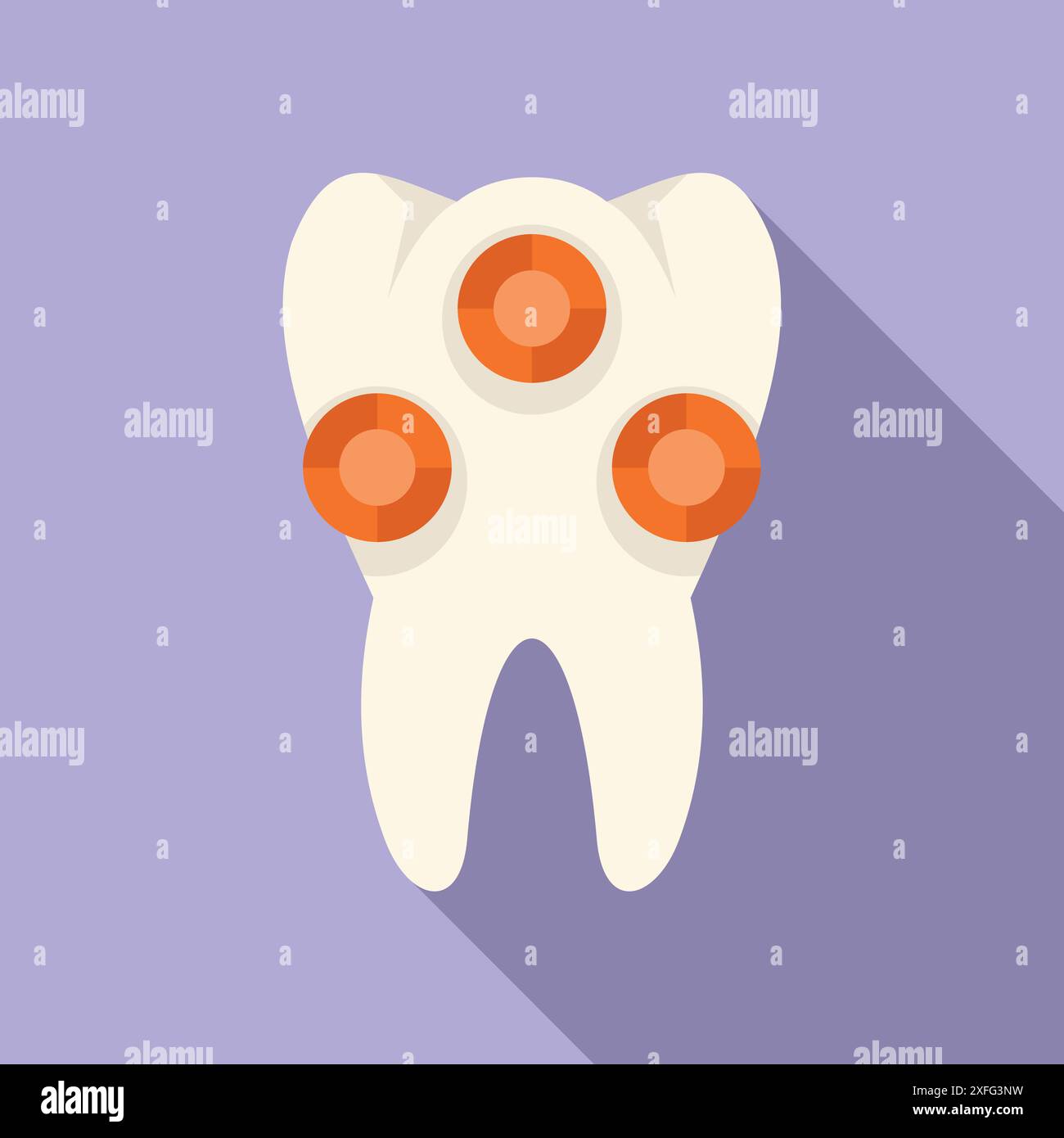 Illustration of a sensitive tooth showing exposed dentin, perfect for ...