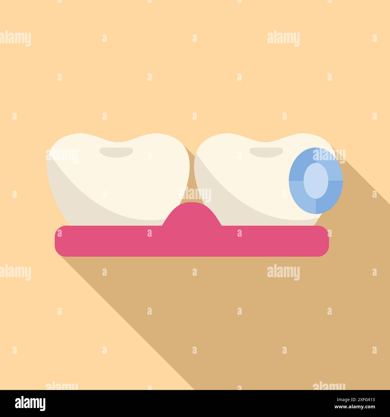 Dental filling is restoring a damaged tooth enamel in this illustration ...