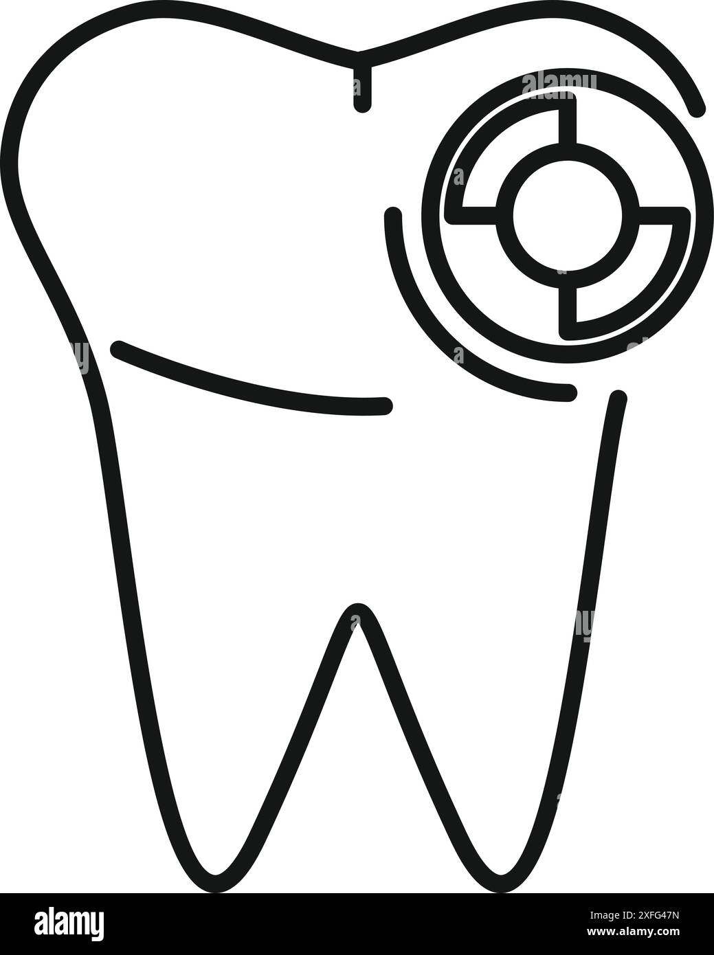 Line drawing of a tooth implant showing the screw and crown Stock ...