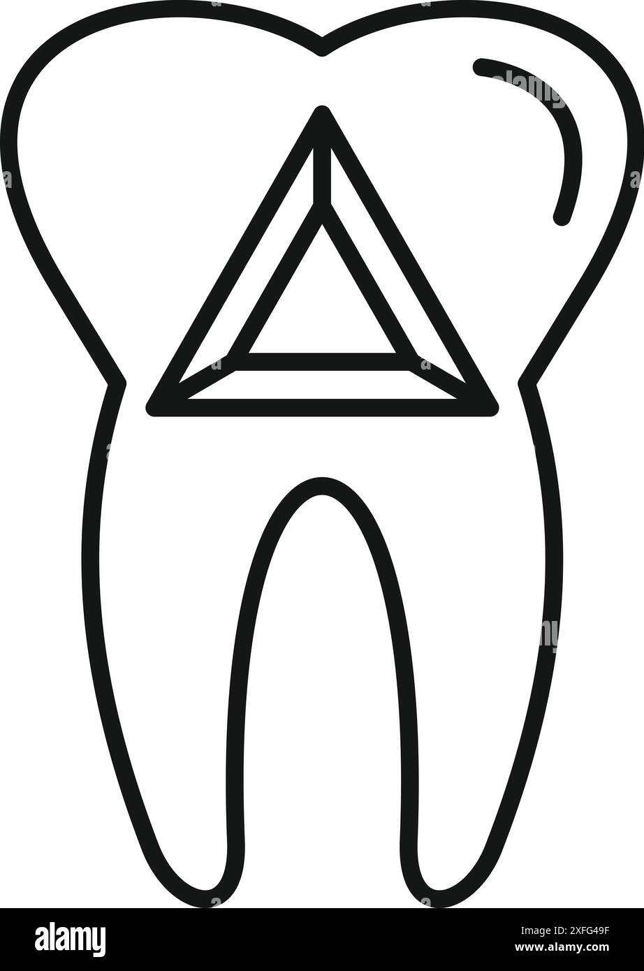 Line drawing of a tooth implant procedure showing a dental implant ...