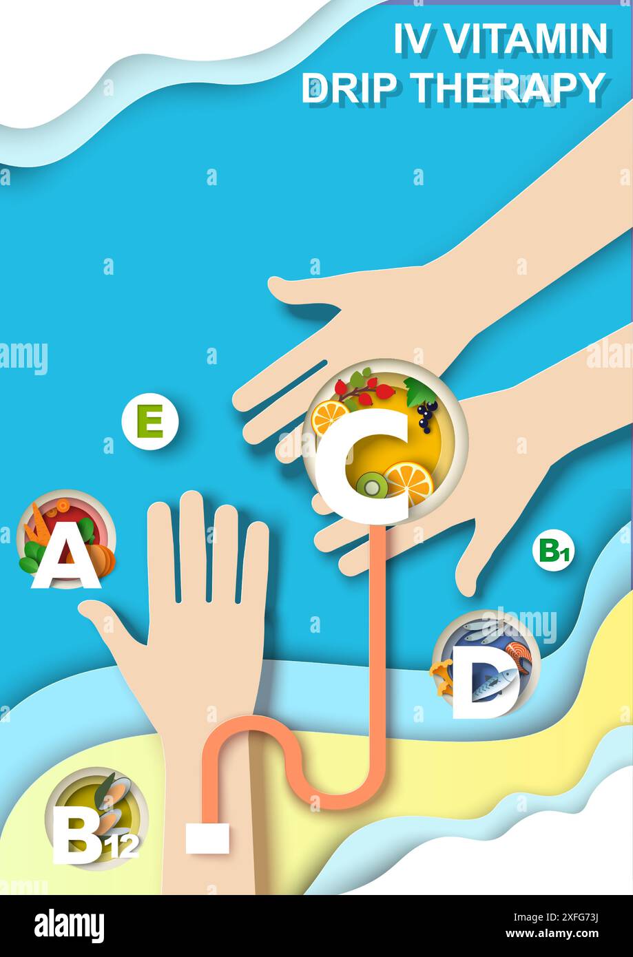 Iv vitamin drip infusion medical therapy vector illustration Stock ...