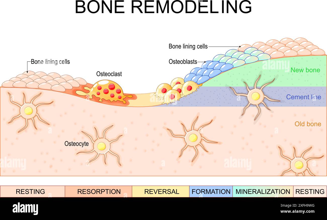 Bone remodeling process. Close-up of Osteoblasts, Osteoclast ... Bone remodeling process. Close-up of Osteoblasts, Osteoclast ...