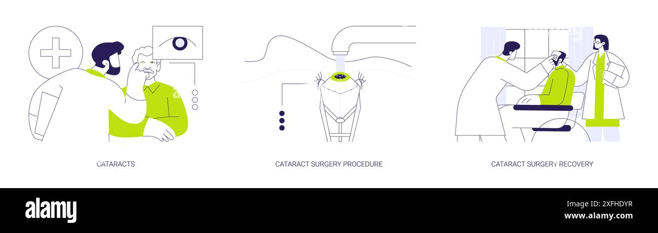 Cataract eye surgery abstract concept vector illustrations Stock Vector ...