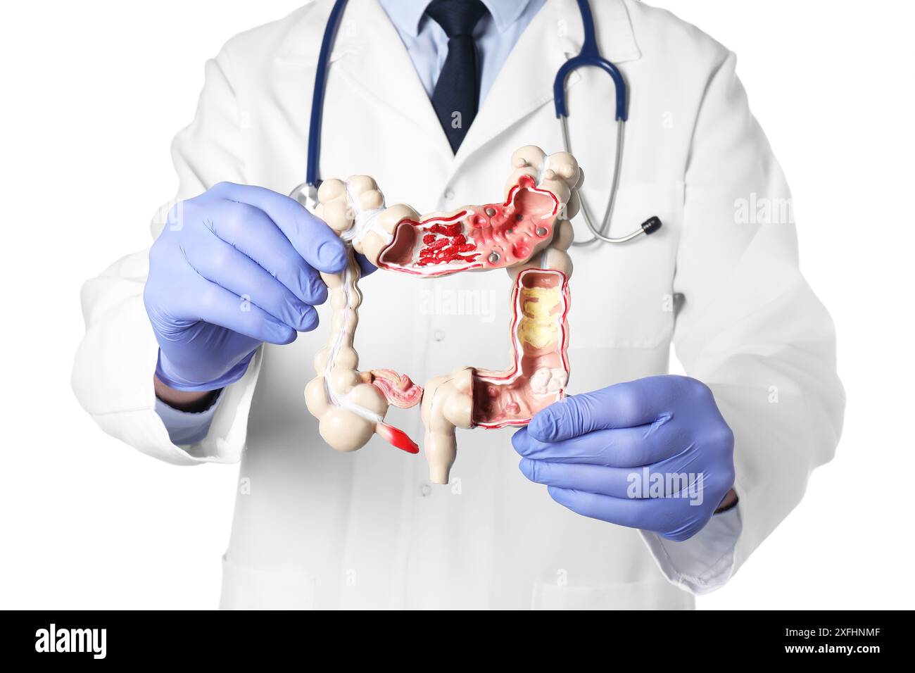Doctor with model of large intestine on white background, closeup Stock ...