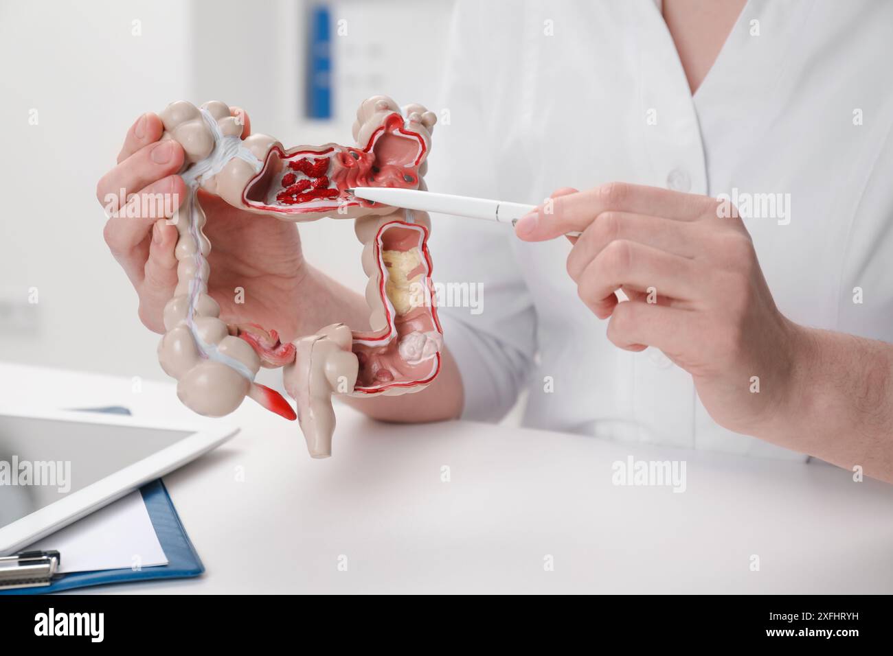Doctor showing model of large intestine at white table in clinic ...
