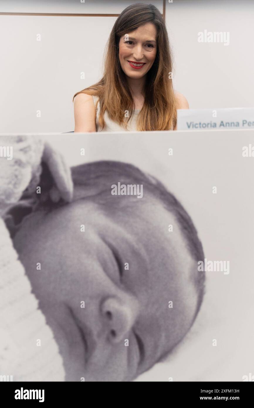 The first person conceived by in vitro fertilization Victoria Anna ...