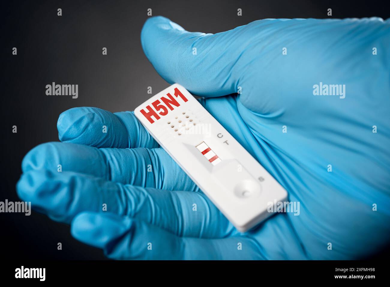 Germany - 02 July 2024: Test or test cassette in a laboratory with ...