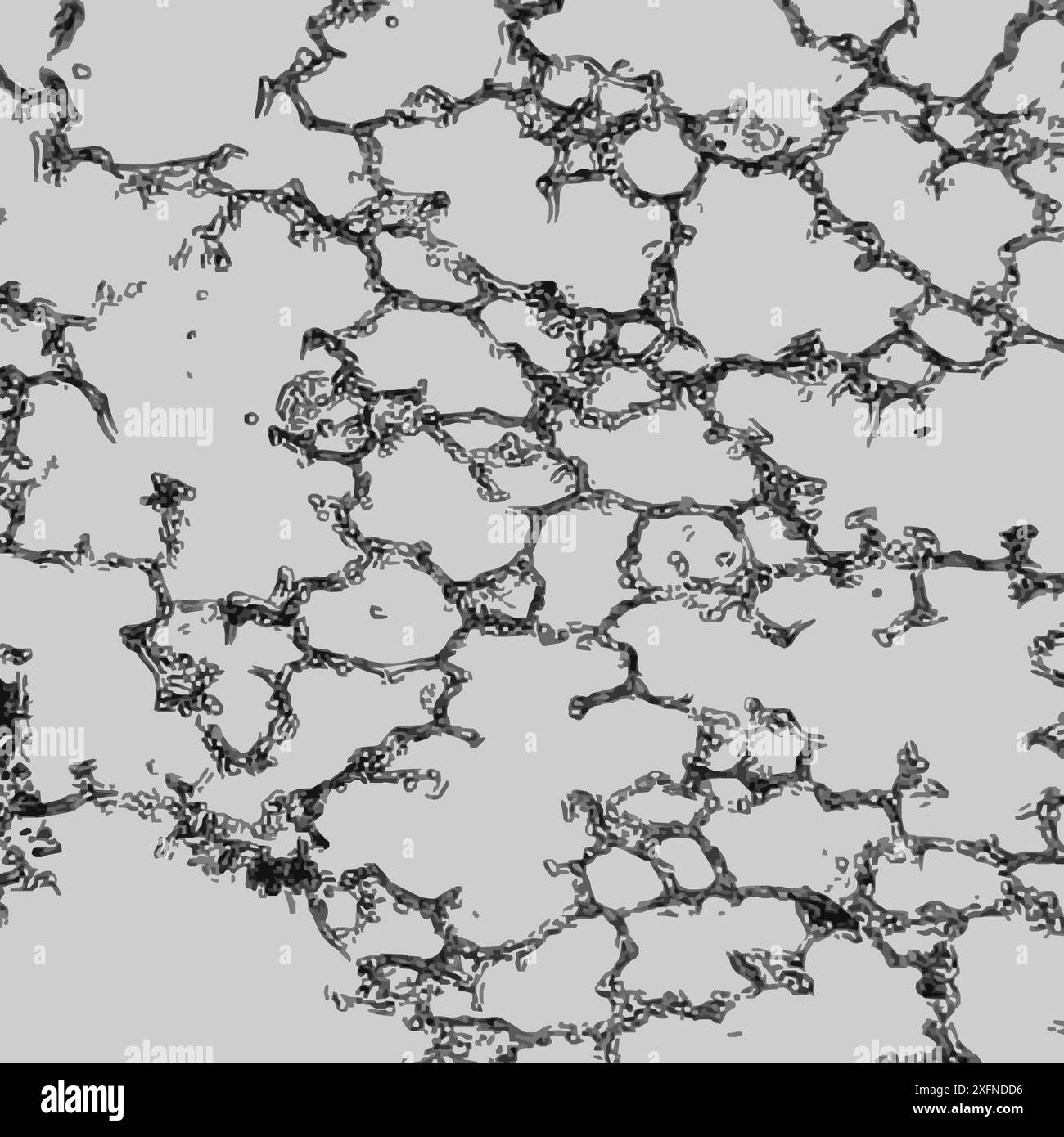 Lungs under microscope - 100x zoom Stock Vector Image & Art - Alamy Lungs under microscope - 100x zoom Stock Vector Image & Art - Alamy