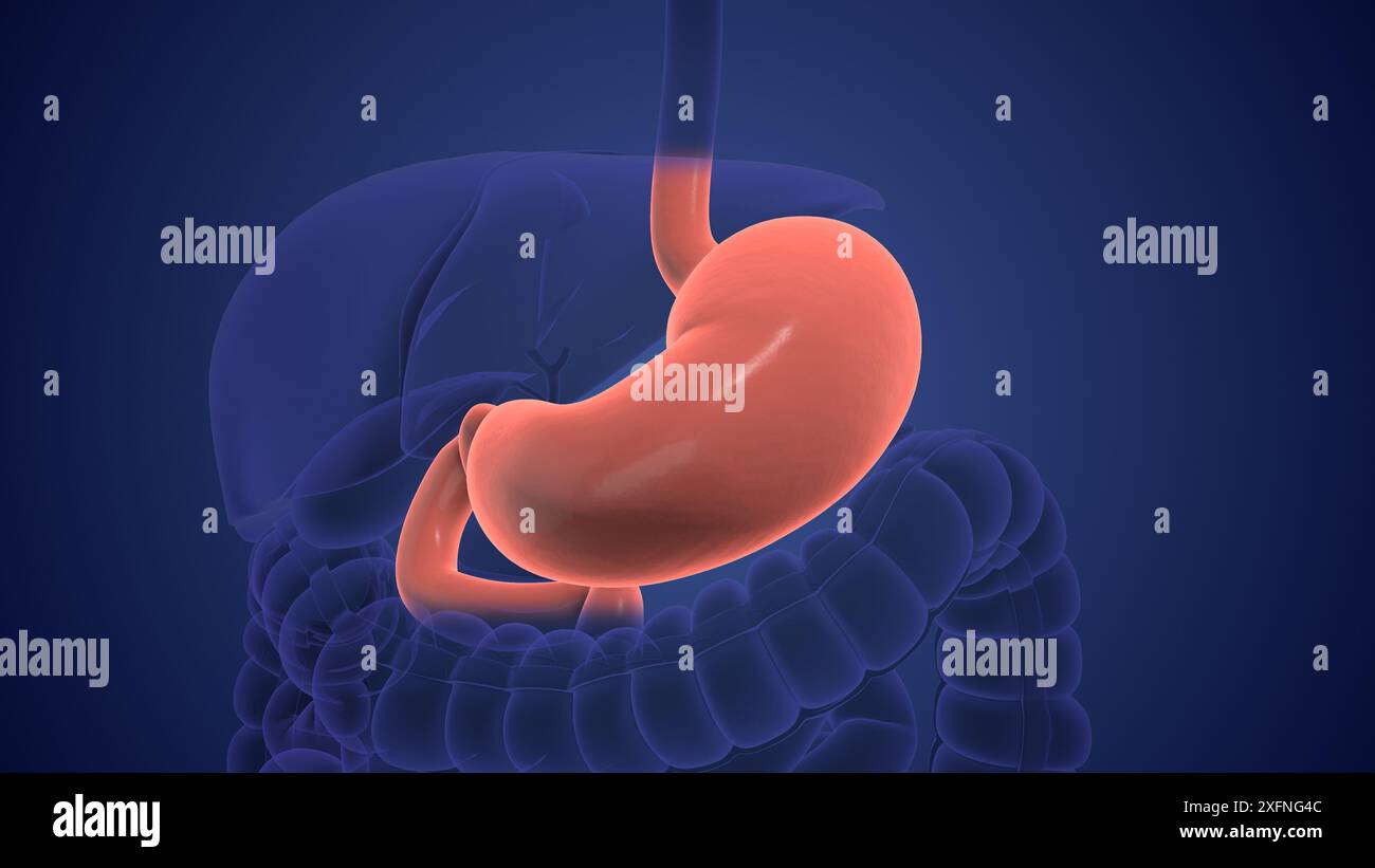 The stomach is affected by Helicobacter pylori bacteria Stock Photo - Alamy