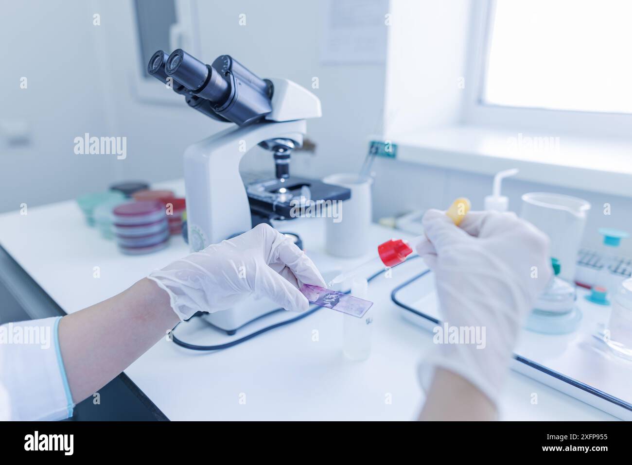 Biochemical test for bacteria hi-res stock photography and images - Alamy