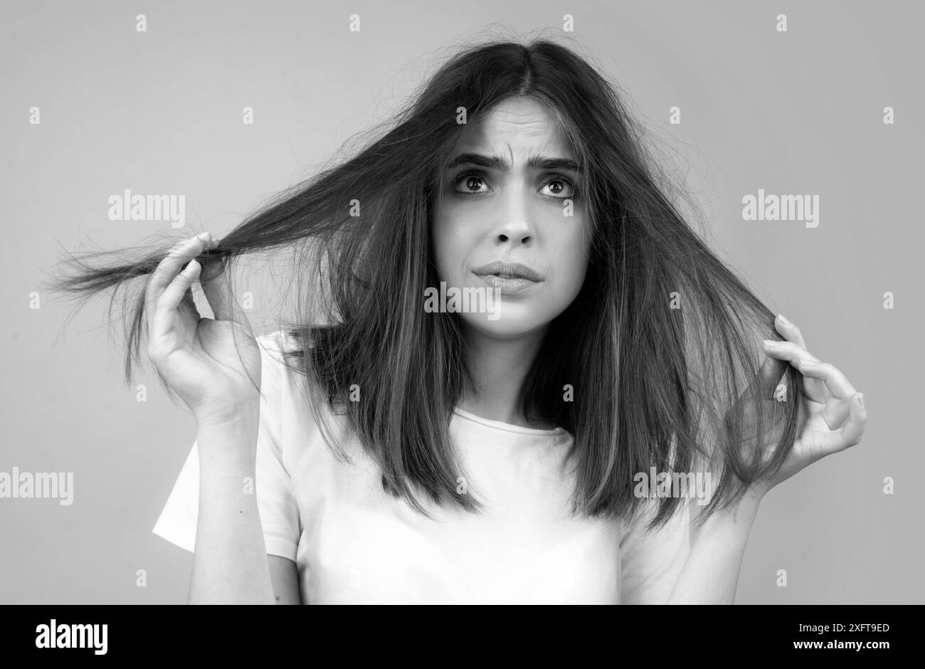 Woman loosing hair. Hair loss problem, baldness Stock Photo - Alamy