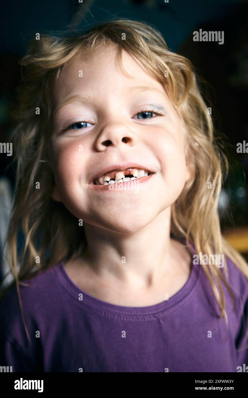 Smiling blonde girl missing tooth hi-res stock photography and images - Alamy