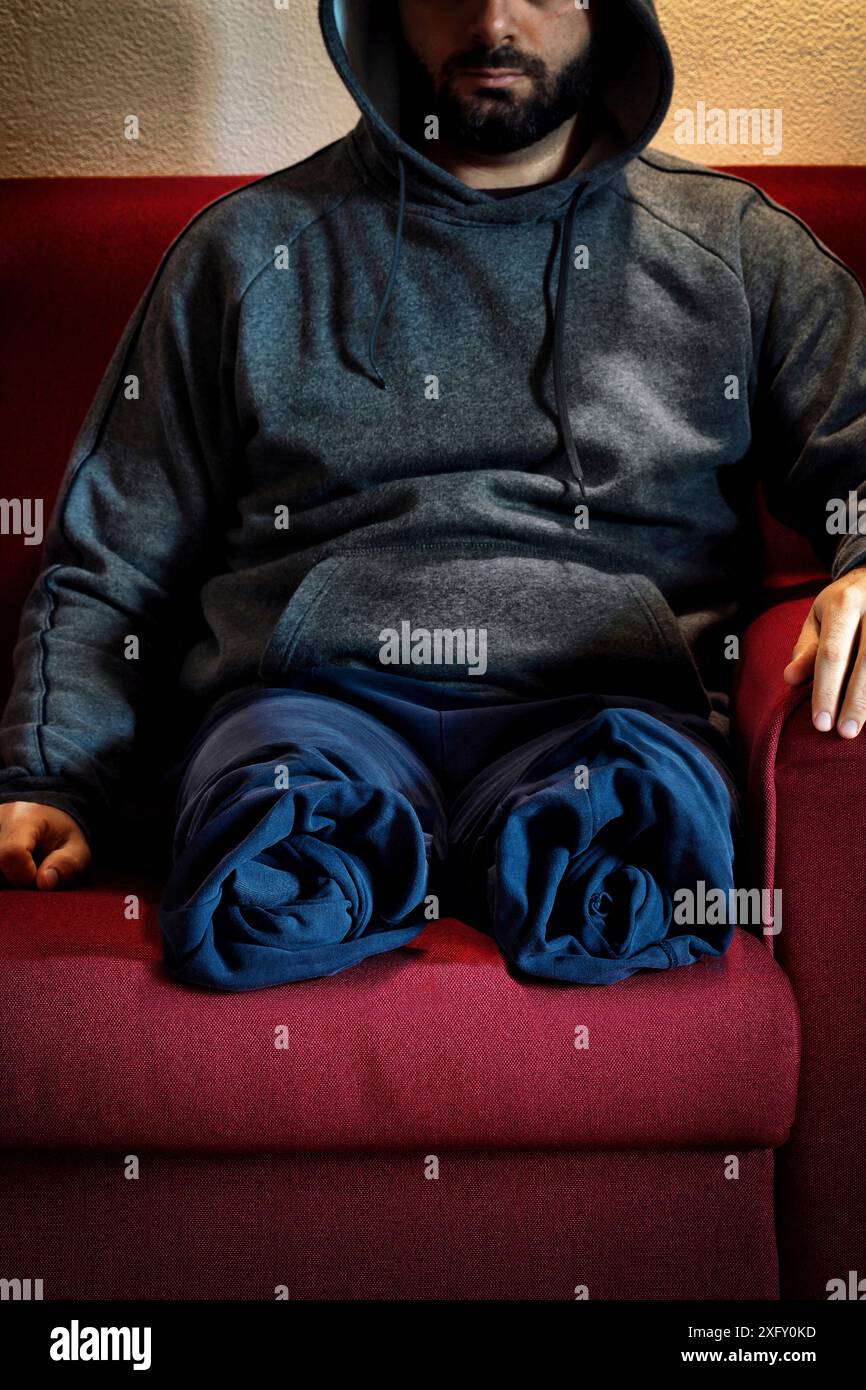 Image representing the problem of people with leg mutilation hi-res ...