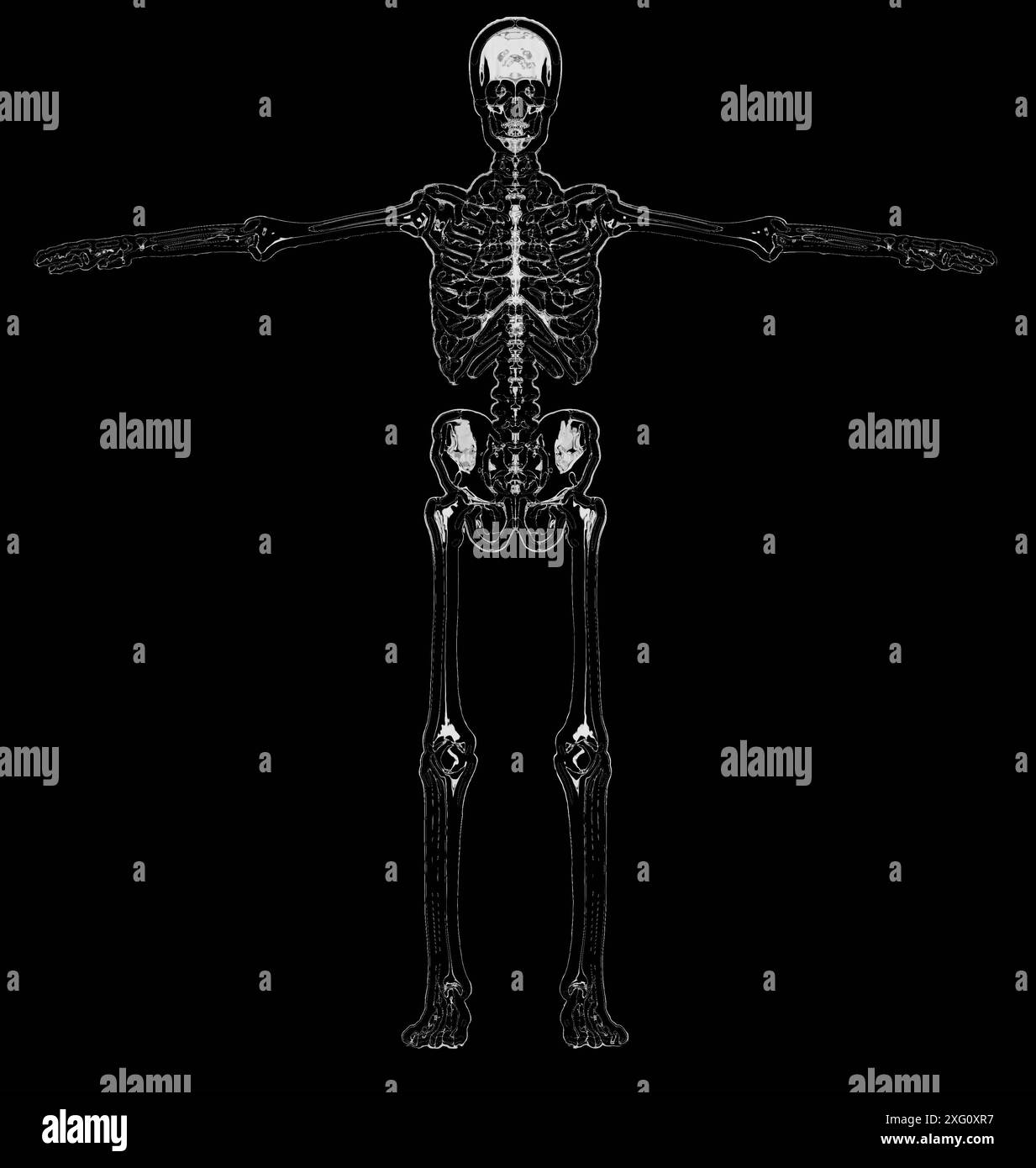 X-ray image of a human skeleton with arms outstretched against a dark ...