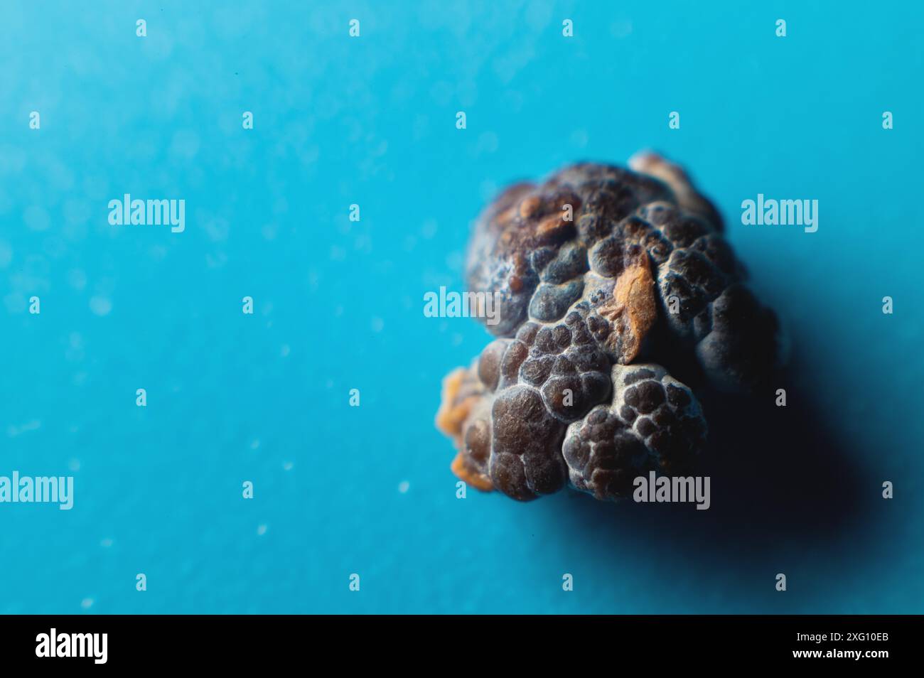 Kidney stone, intact, formed in an alkaline environment in the kidneys ...
