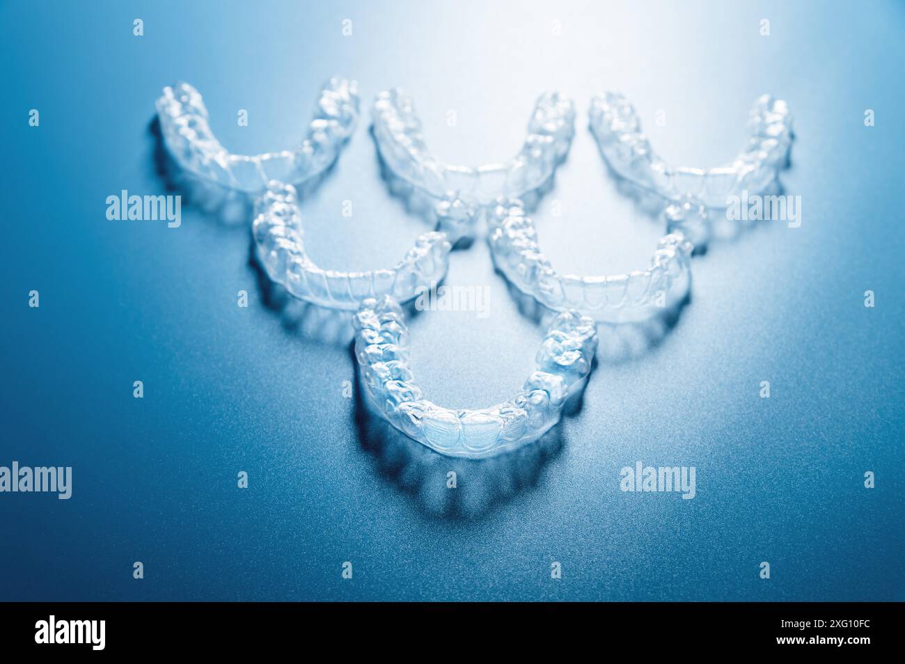 Invisible plastic braces lie in a reverse inverted pyramid shape in a ...