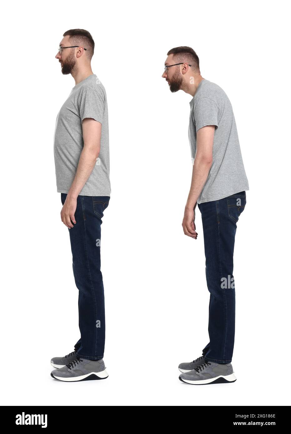 Man with poor and good posture on white background, collage of photos ...