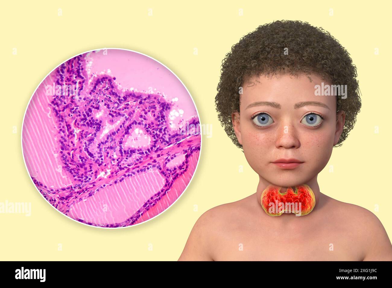 Endocrine system child hi-res stock photography and images - Alamy