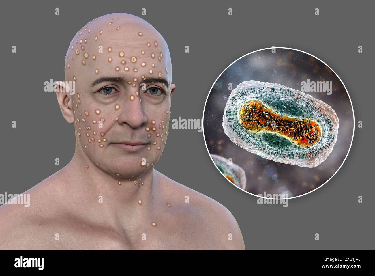 Rash face hi-res stock photography and images - Alamy