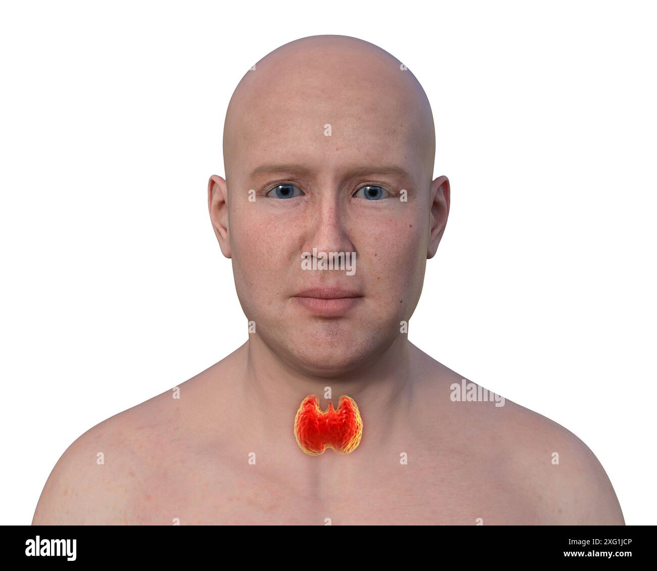 Illustration of a man's head, neck and shoulders with the thyroid gland ...