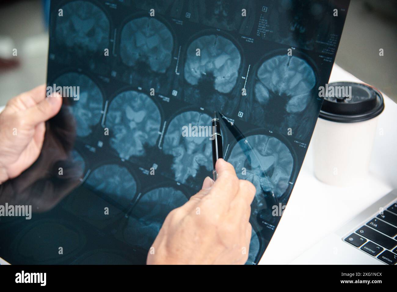 doctor is diagnosing brain problems using x-ray films Stock Photo - Alamy