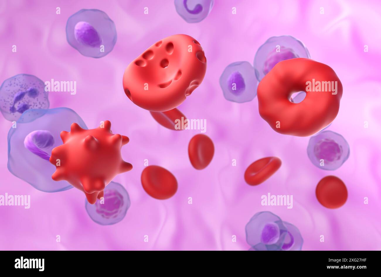 Damaged Red blood cells in Hemolysis - closeup view 3d illustration ...