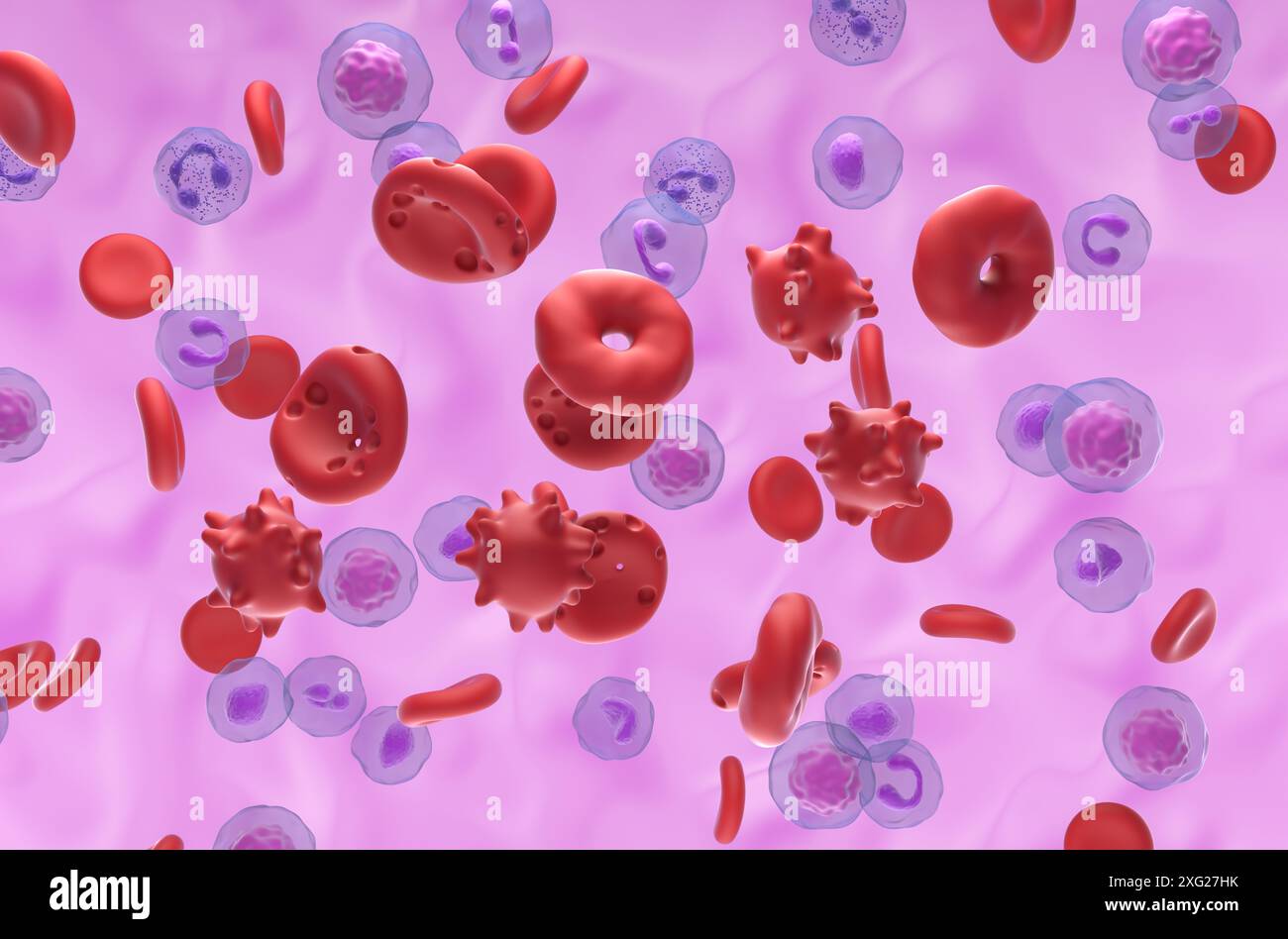 Damaged Red blood cells in Hemolysis - isometric view 3d illustration ...