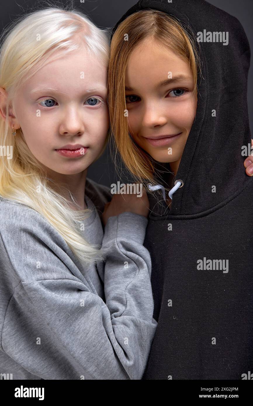 best friends support each other, albino with unusual blue eyes hug her ...