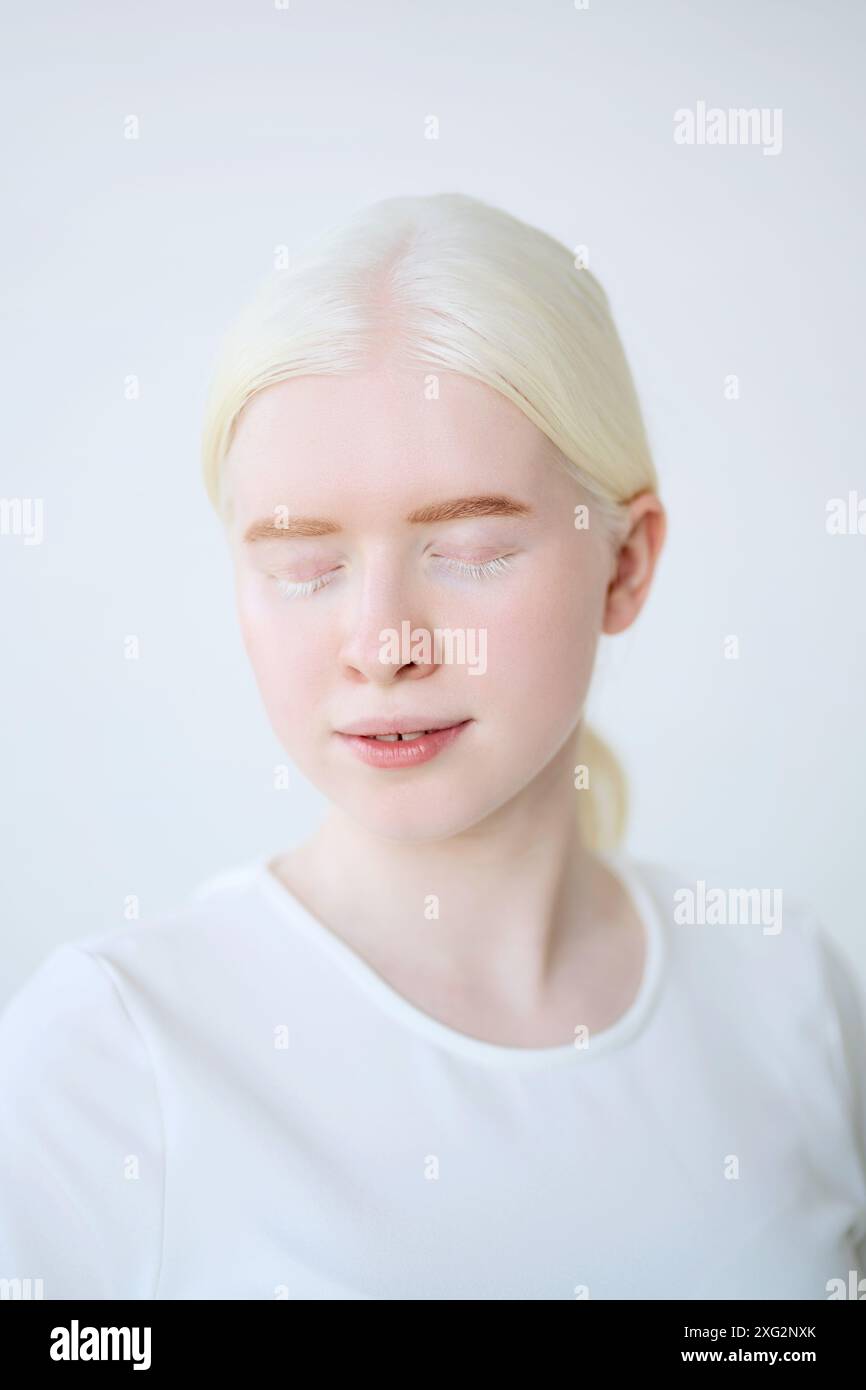 Beautiful inclusive albino teen girl wearing white t-shirt on ...
