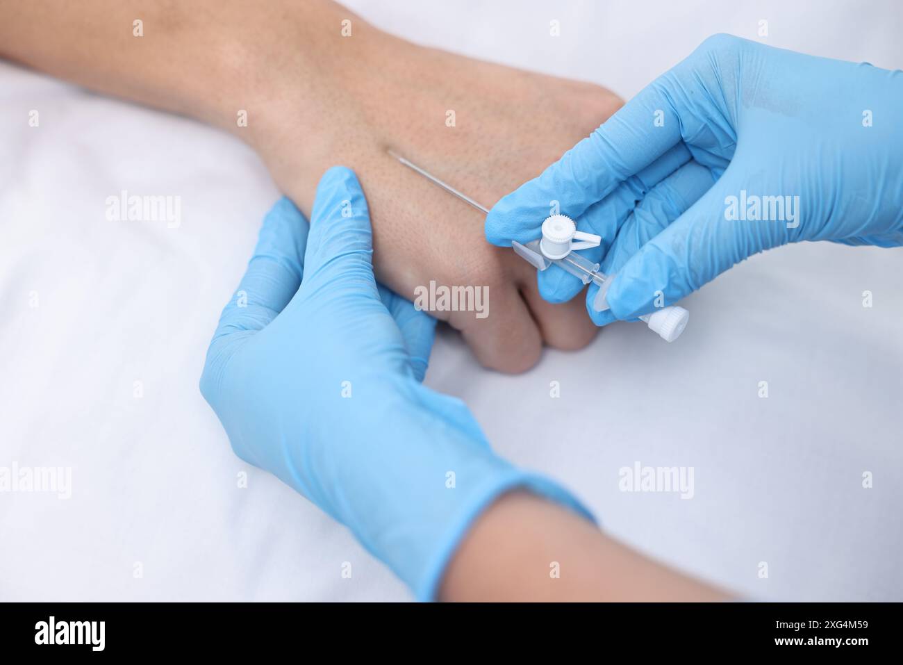 Nurse inputting catheter for IV drip in patient hand, closeup Stock ...