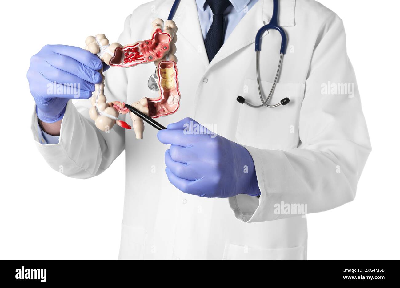 Doctor showing model of large intestine on white background, closeup ...