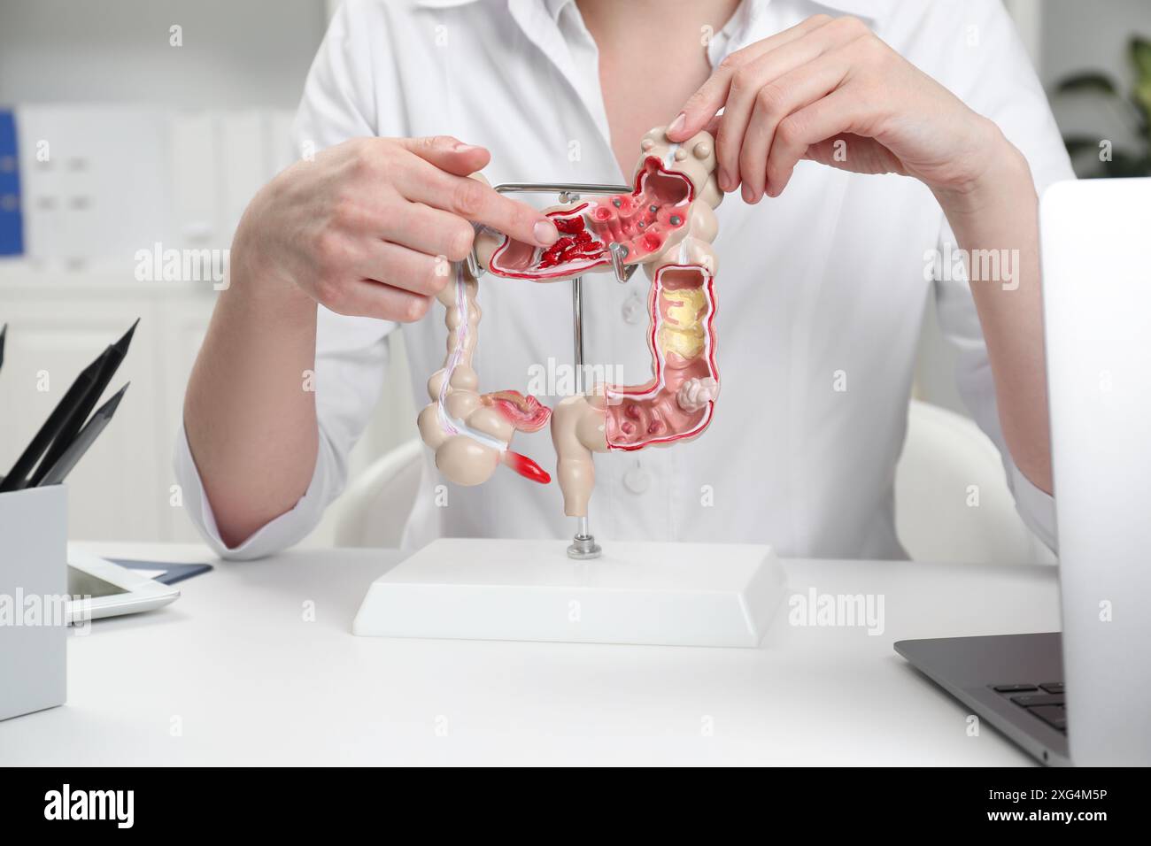 Digestive system in female anatomy hi-res stock photography and images ...