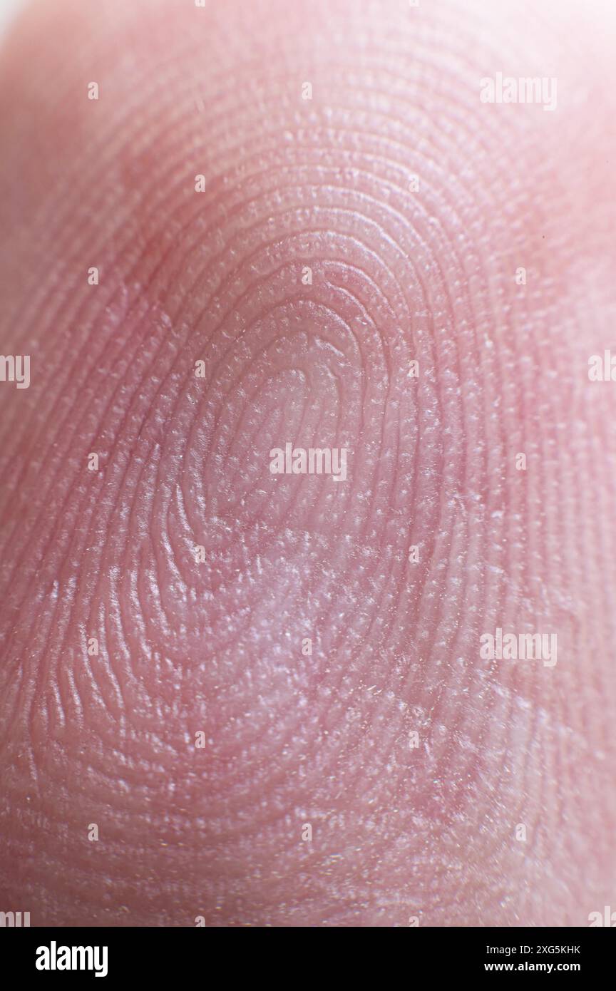 Surface anatomy hi-res stock photography and images - Alamy