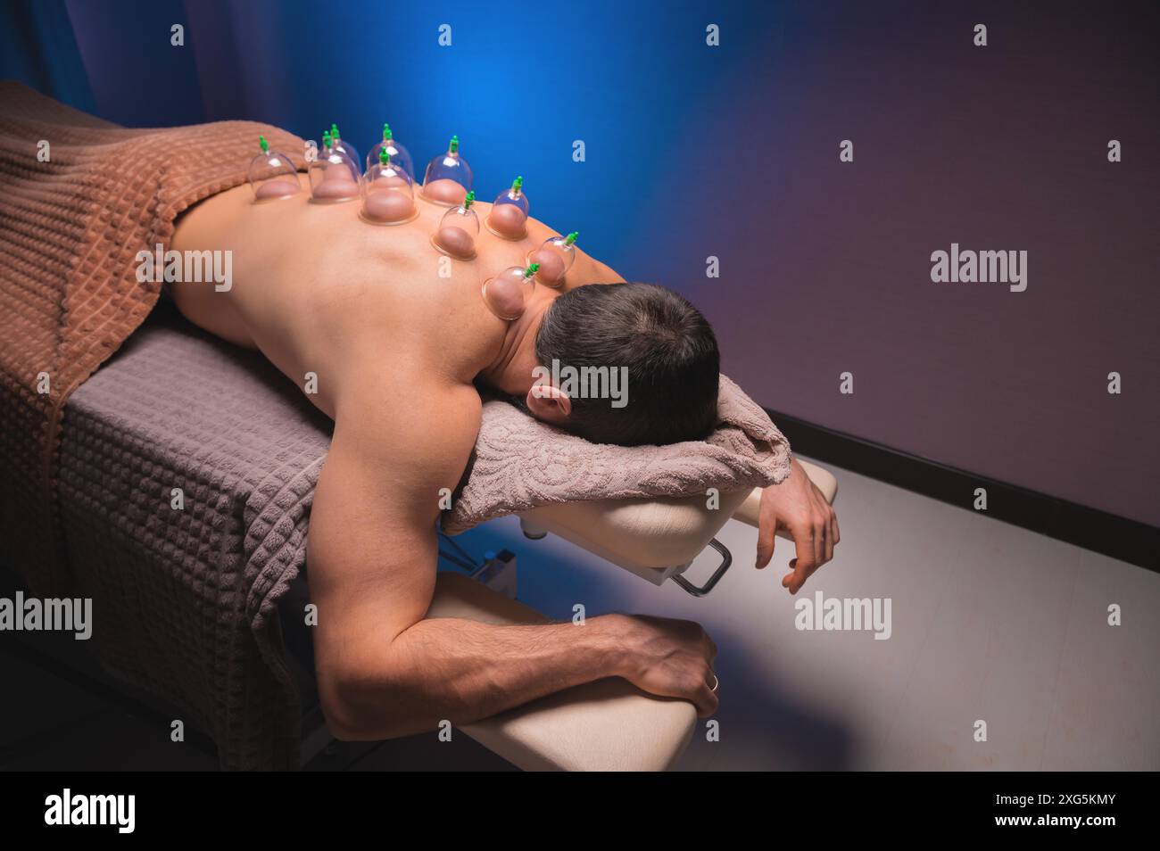Relaxed young muscular man getting cupping treatment on his back lying ...
