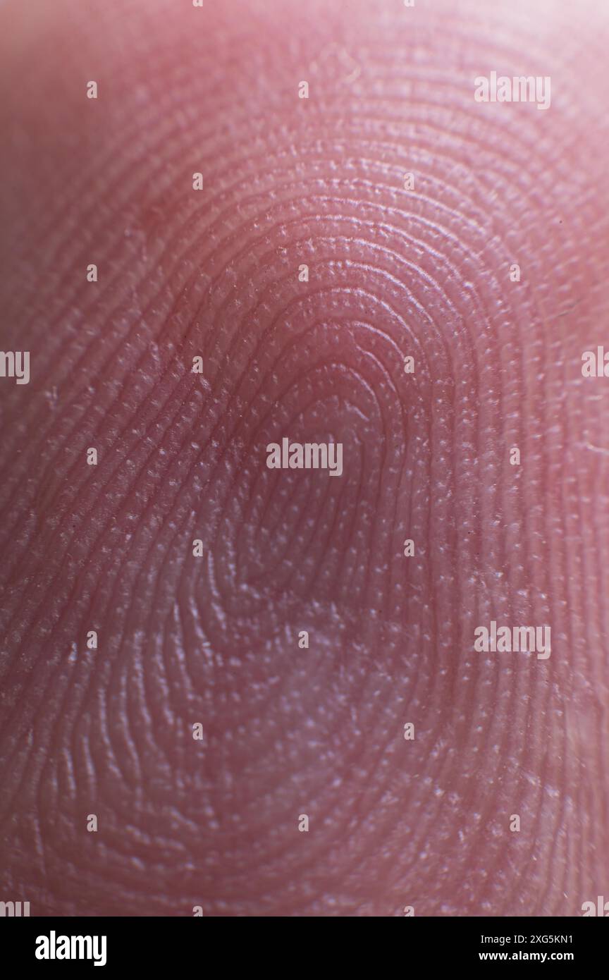 Surface anatomy hi-res stock photography and images - Alamy