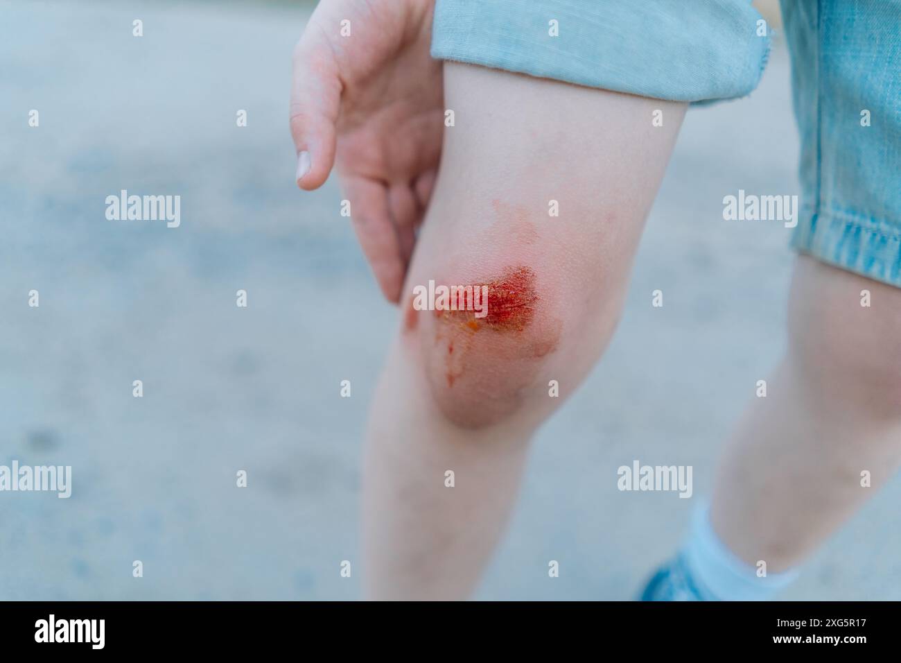 Close up knee visible hi-res stock photography and images - Alamy