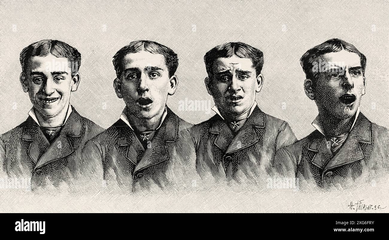 Different expressions of a subject in a cataleptic state. Old 19th ...