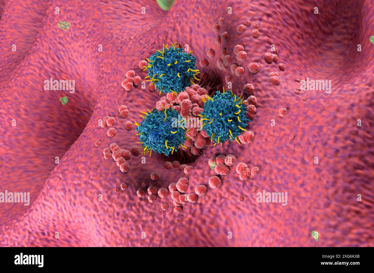 3d illustration, abdominal, acid, alcohol, antigen, biological, biopsy ...