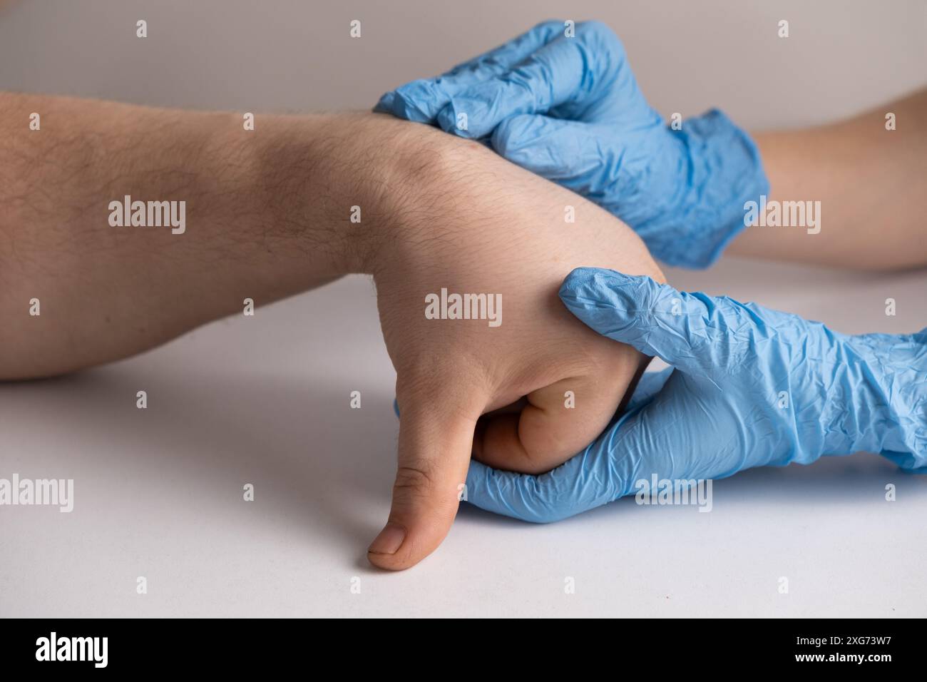 Examination wrist joint hygroma hi-res stock photography and images - Alamy