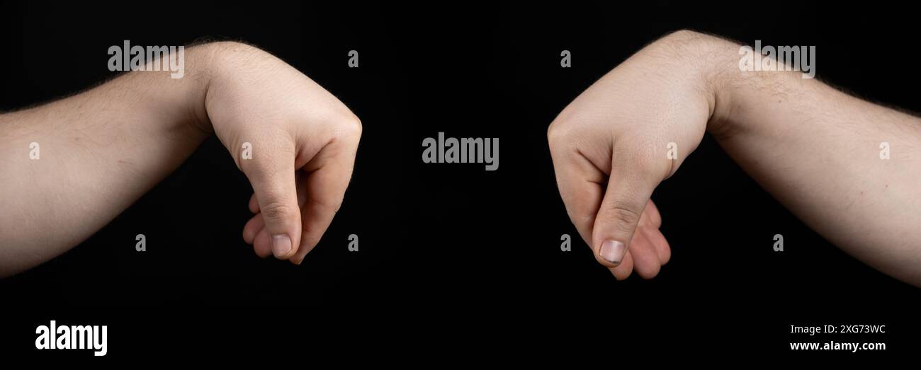 Comparison of healthy arm and arm with wrist ganglion cyst on black ...