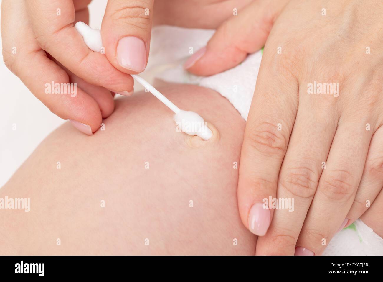 Close-up of mother or pediatrician wipes belly button of newborn baby ...