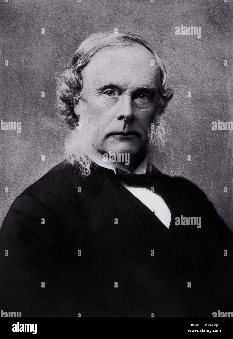 A Formal Portrait of Sir Joseph Lister, Baron Lister, a Pioneer in ...