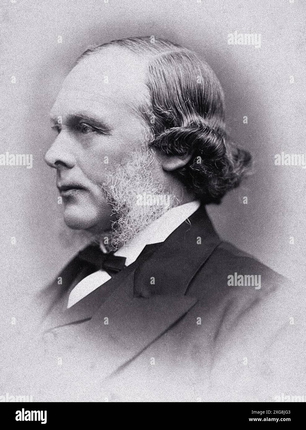 A Formal Portrait of Sir Joseph Lister, Baron Lister Stock Photo - Alamy