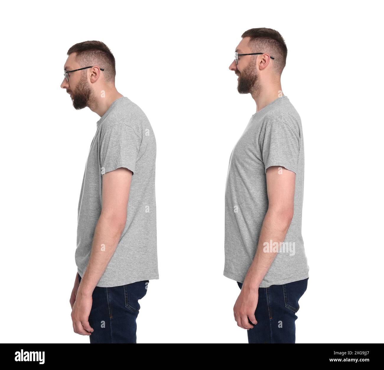 Man with poor and good posture on white background, collage of photos ...
