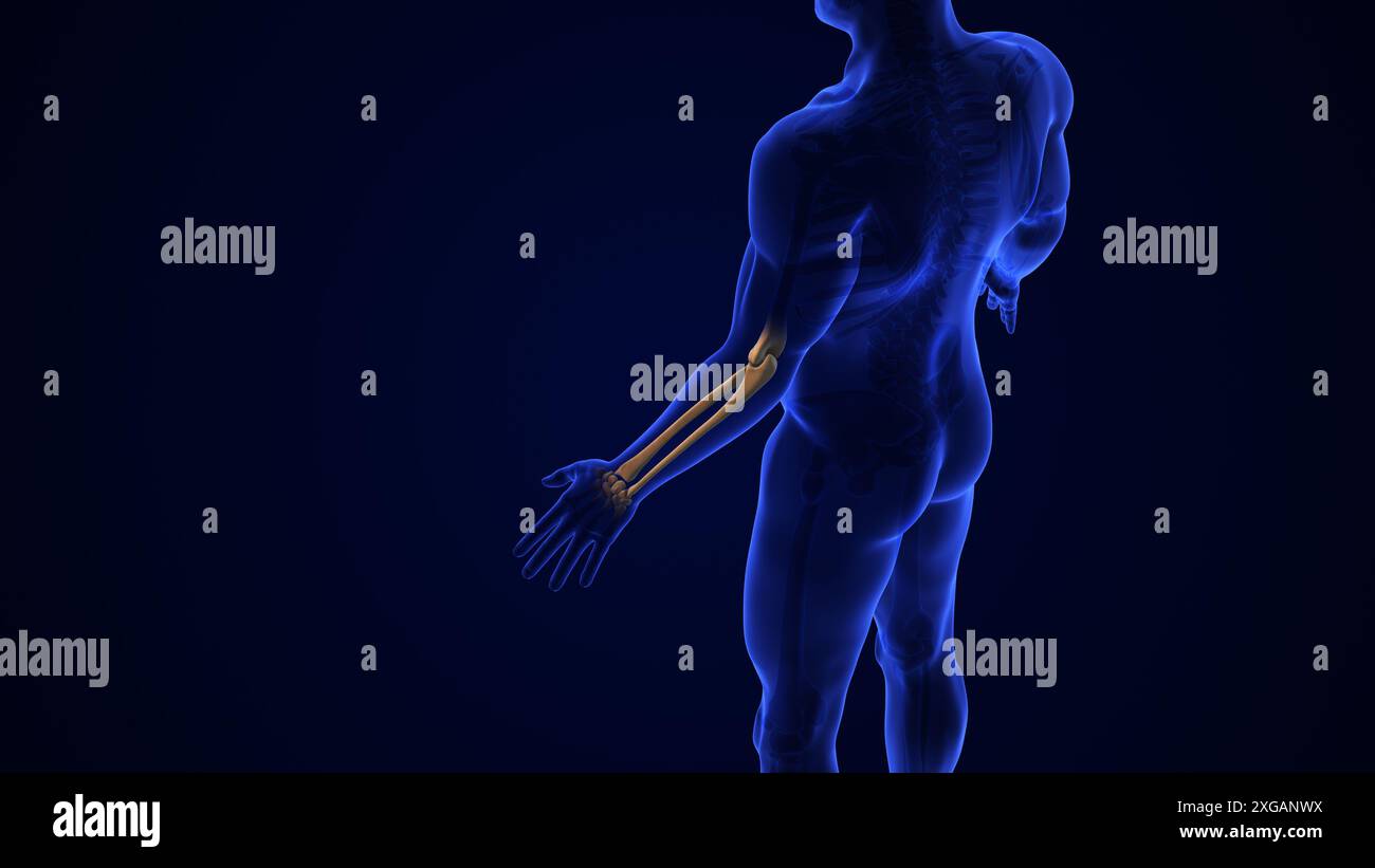 Broken Ulna Bone medical concept Stock Photo - Alamy